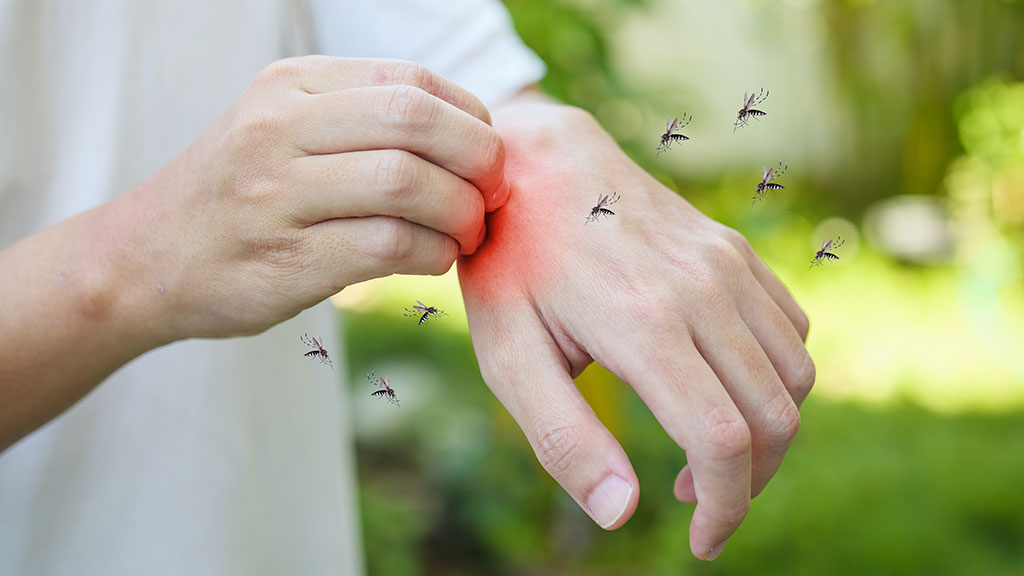 আসলেই কিছু মানুষকে মশা কামড়ায় বেশি