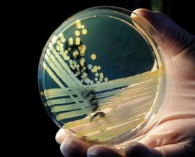 Dangerous TB spreading at alarming rate in Europe: WHO