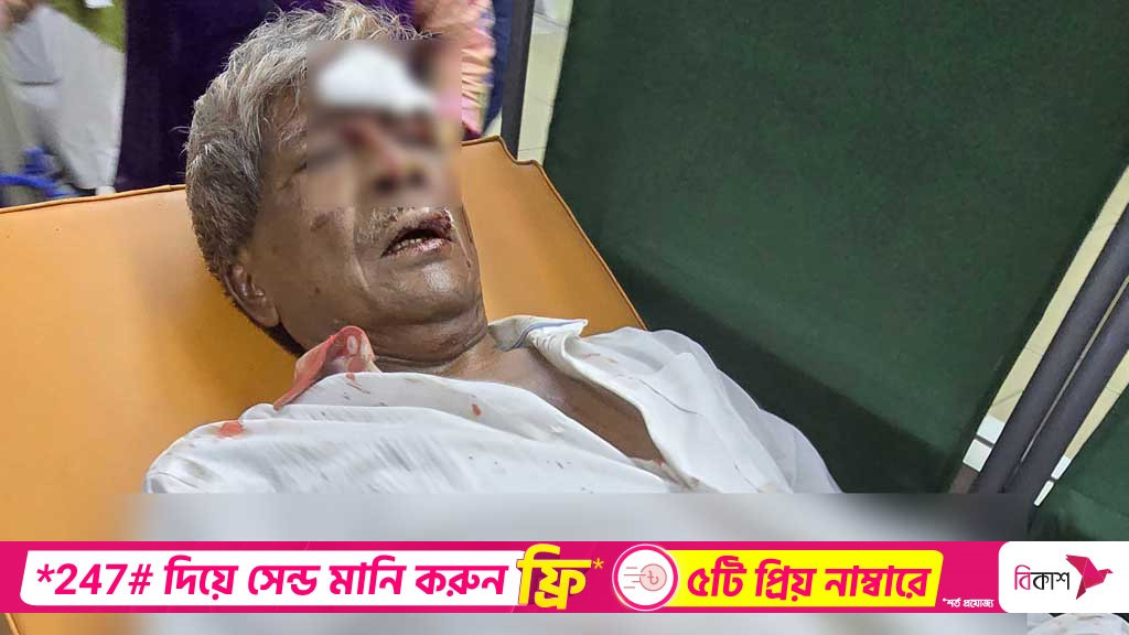 Former VC Anwar Hossain attacked near Dhaka airport