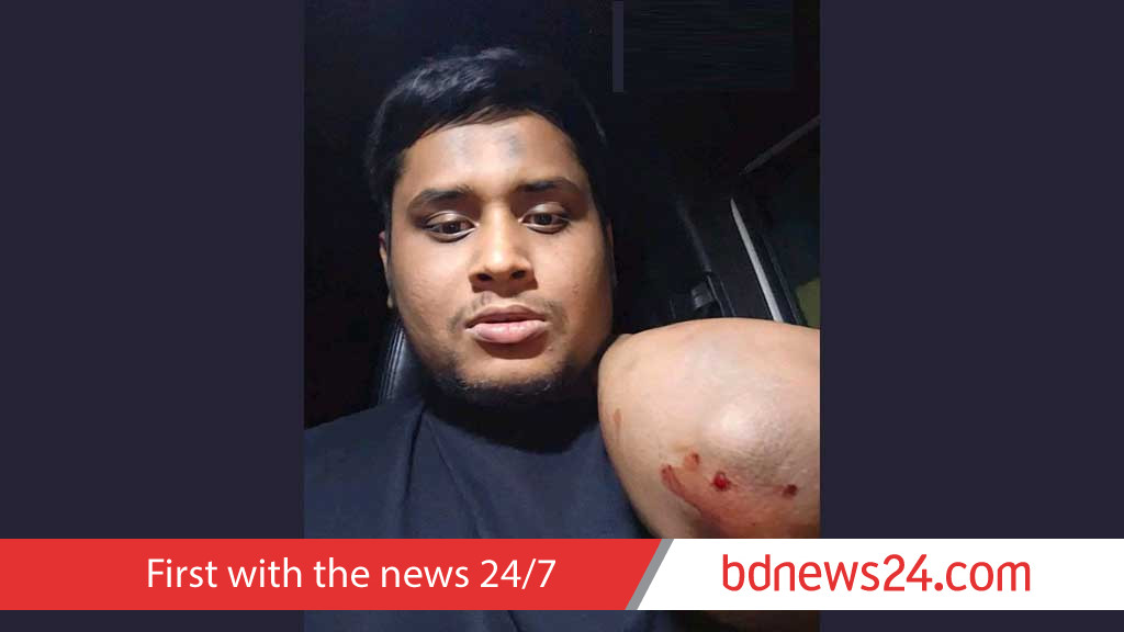 NCP’s Hasnat attacked in Gazipur